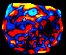 Mass General Imaging: Advanced Imaging Techniques