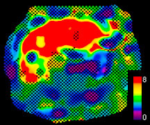 Mass General Imaging: Advanced Imaging Techniques