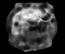 Mass General Imaging: Advanced Imaging Techniques